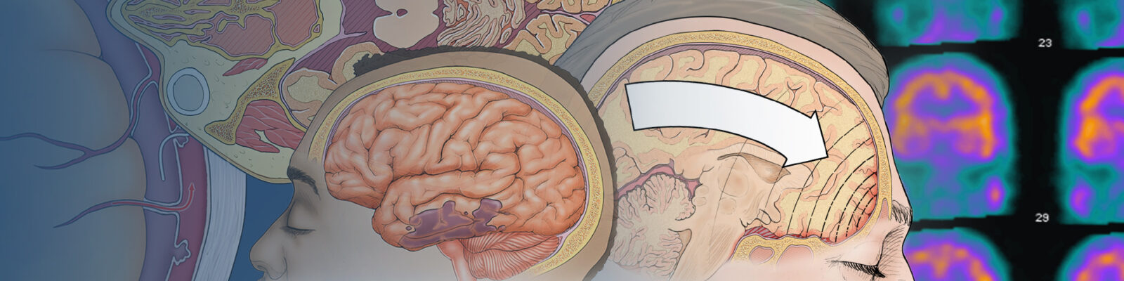 Brain Injury Illustrations & Animations | Artery Studios