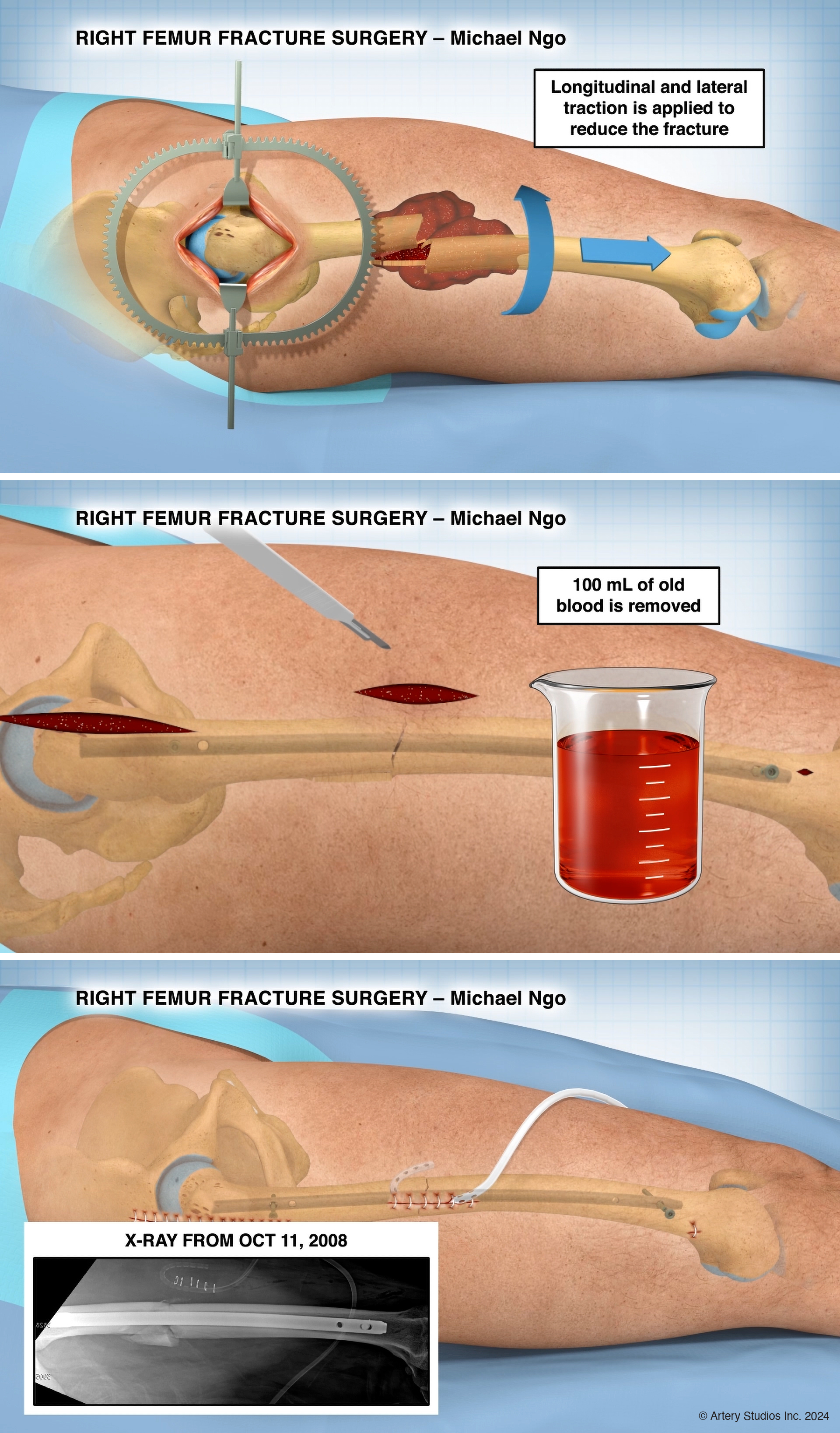 $8.2M win on $100k offer with medical animations - Artery Studios